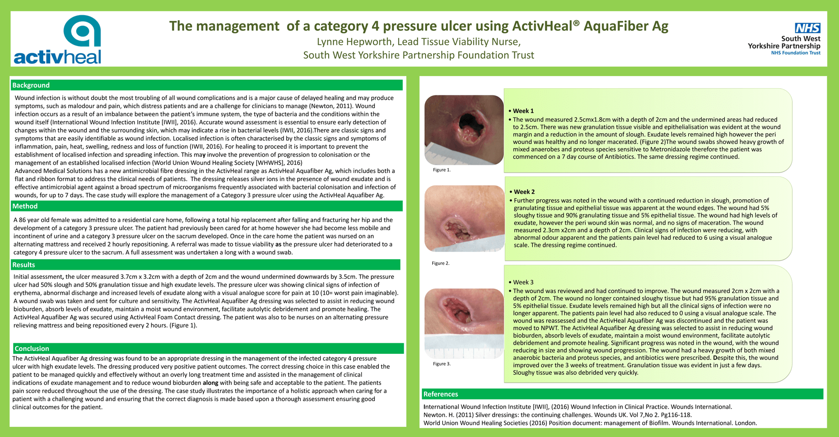 CLINICAL RESOURCE: The management of a category 4 pressure ulcer using ...